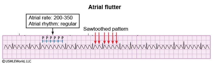 [nclex] Cardiovascular : 네이버 블로그